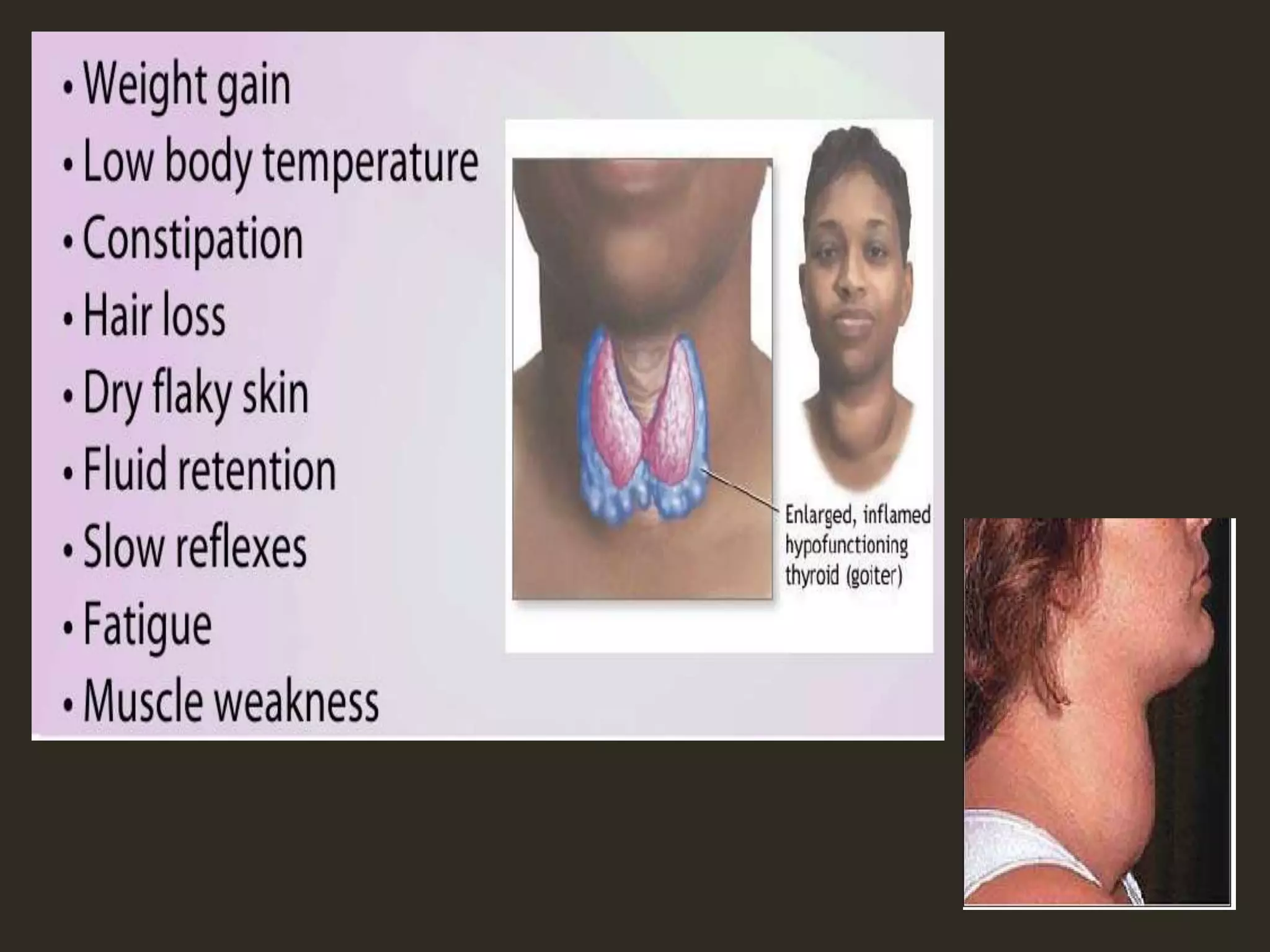 Organ specific autoimmune | PPTX