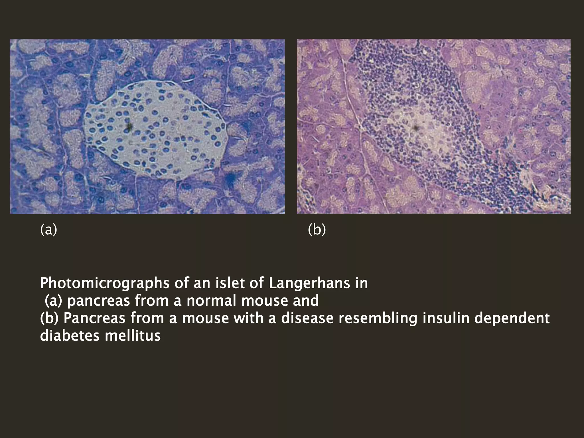 Organ specific autoimmune | PPTX