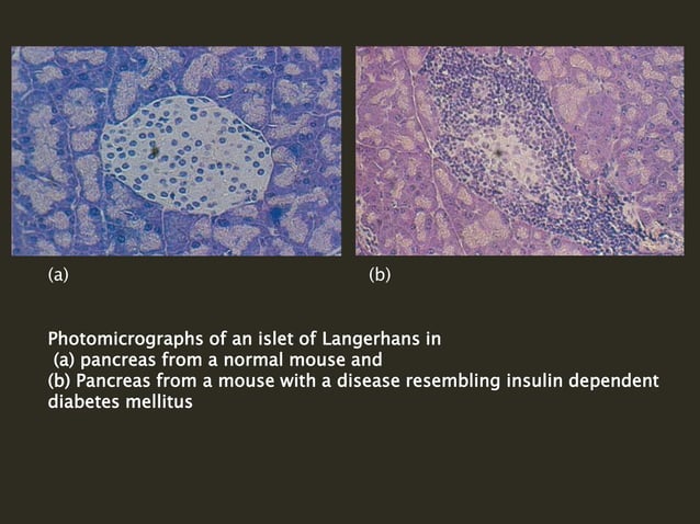 Organ specific autoimmune | PPTX