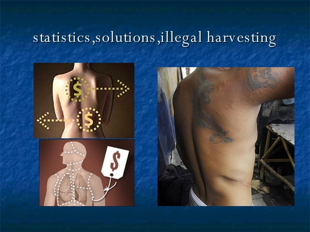 Organ Trafficking | PPT