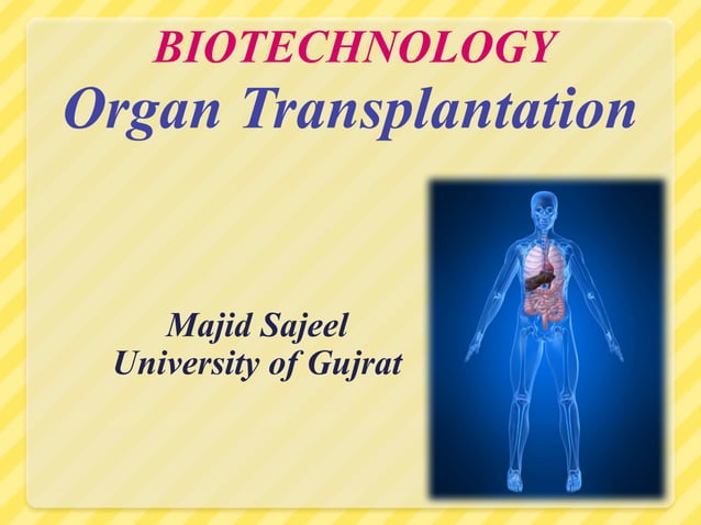 organ -transplantation medical procedure | PPT