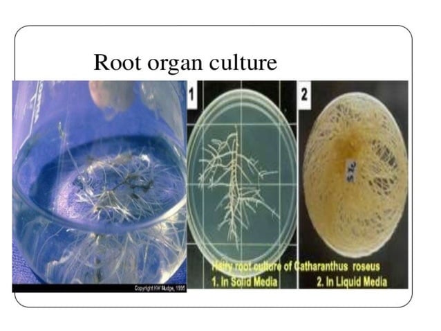 Organ culture in plant biotechnology