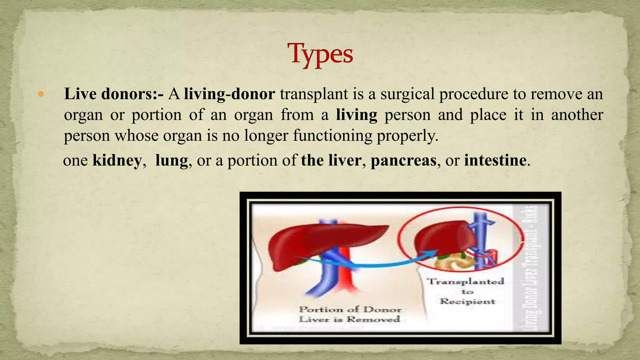 Organ donation | PPTX