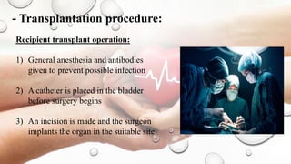 Organ donation.pptx