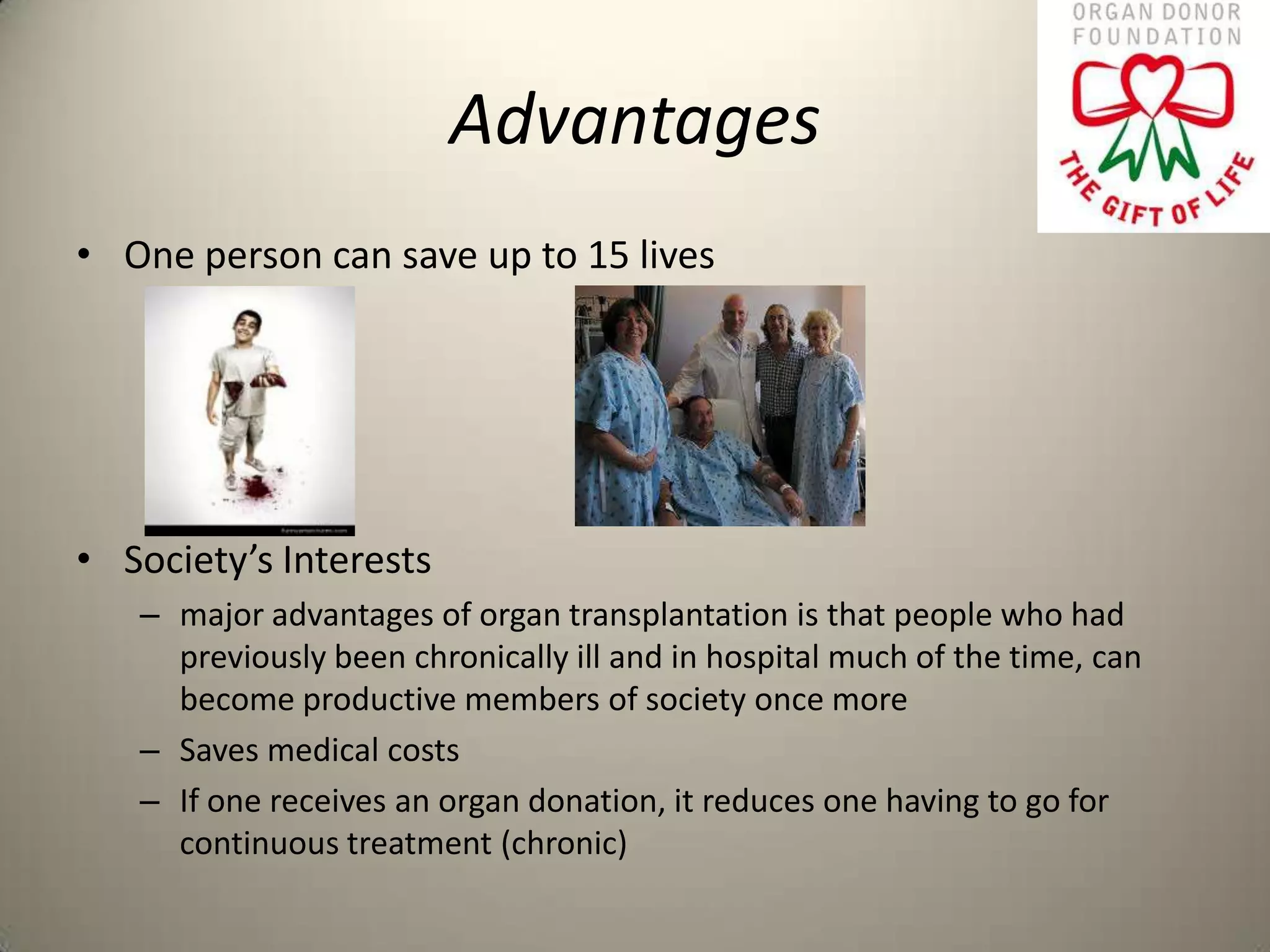 Organ Donation Presentation | PPTX | Surgery | Medical Health