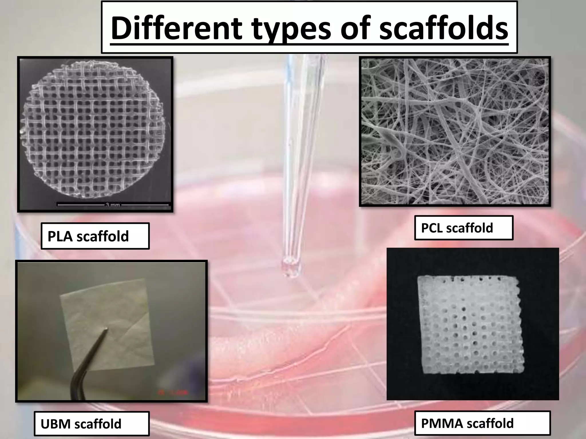 Organ and tissue engineering,examples, | PPTX
