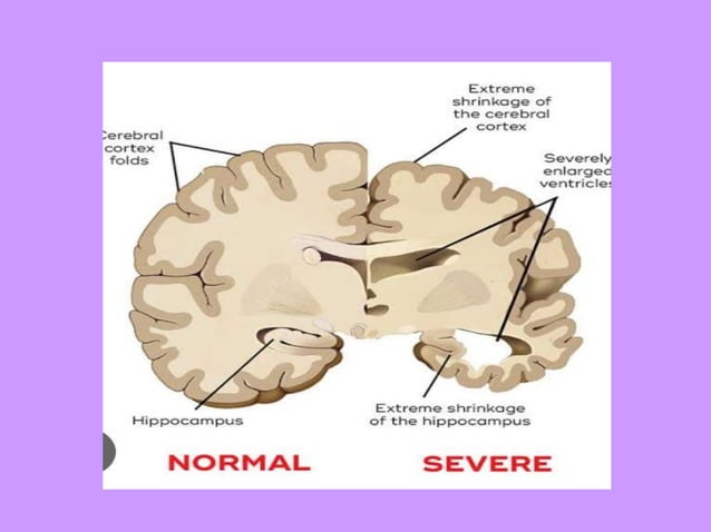 organic brain disorder.pptx its classification | PPT