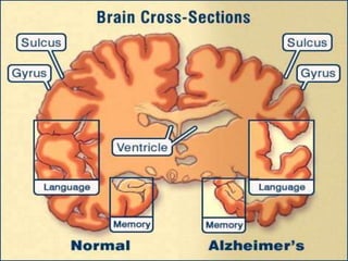 Organic brain syndrome | PPTX