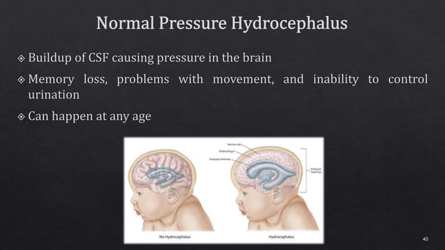Organic brain syndrome | PPT