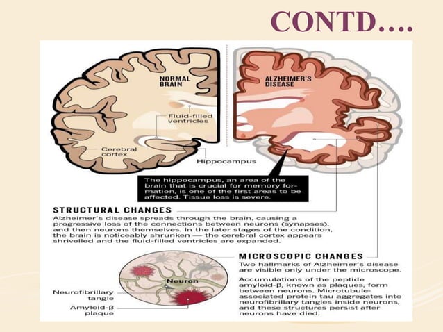 Organic Disorders | PPTX | Brain and Nervous System Disorders ...