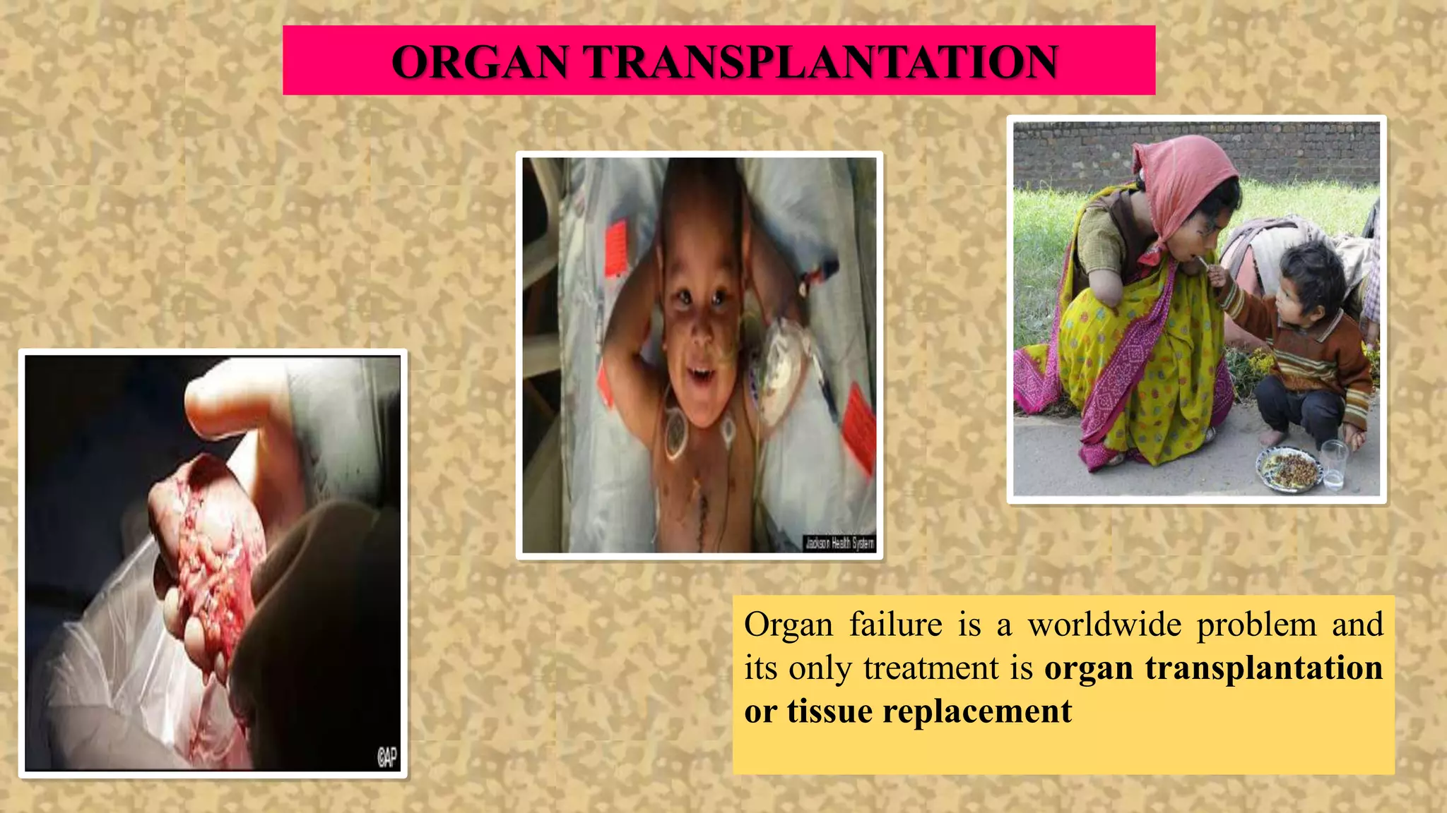 Organ printing (or) Bio Printing | PPTX