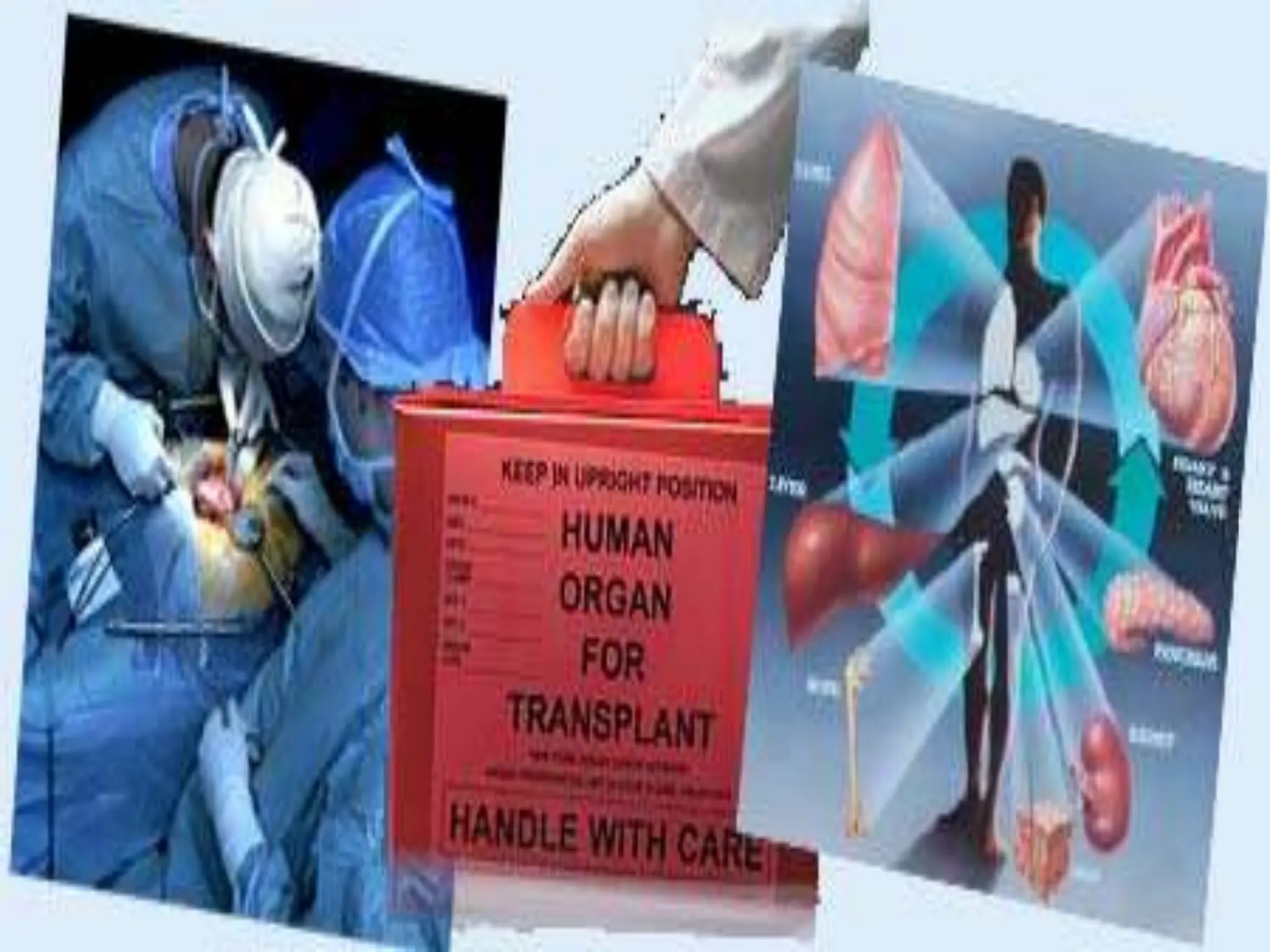 Organs Transplants 2024.ppt ahmed fahmy a | PPT