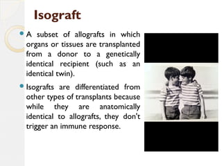 Organ transplantation | PPT | Surgery | Medical Health