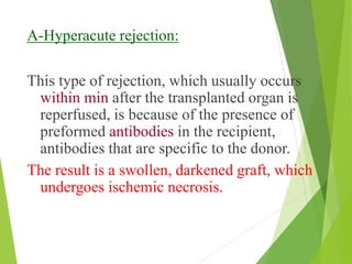 Organ transplantation | PPT