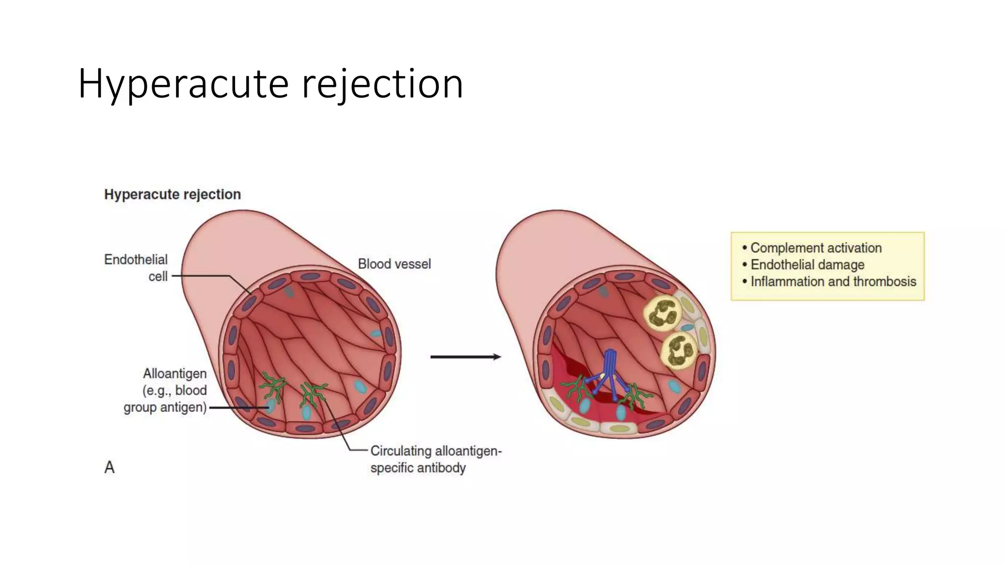 ORGAN TRANSPLANTATION.pptx