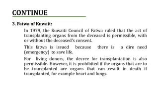 Organ Transplantation from Islamic Law Perspective | PPT