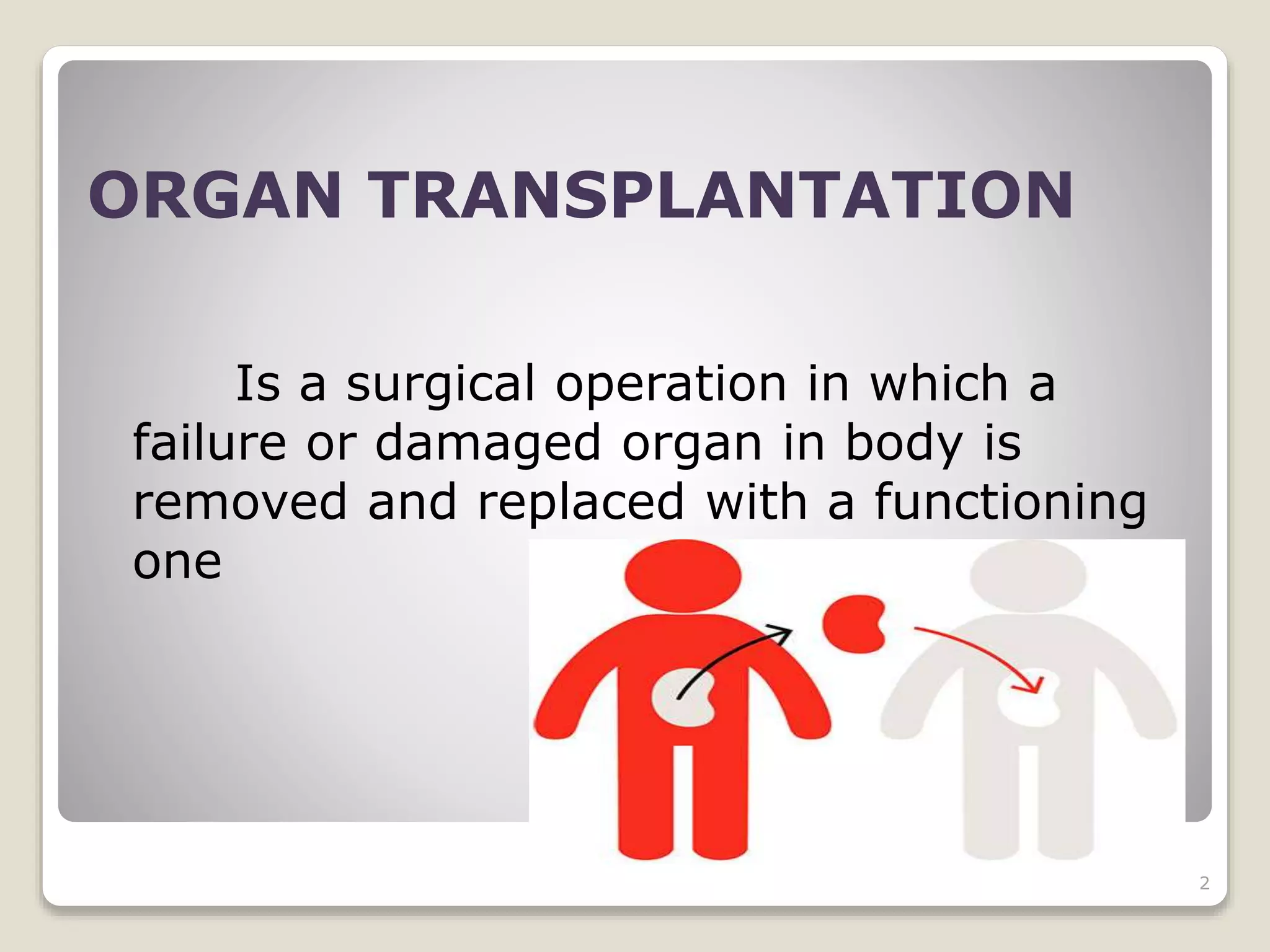 Organ transplantation | PPTX