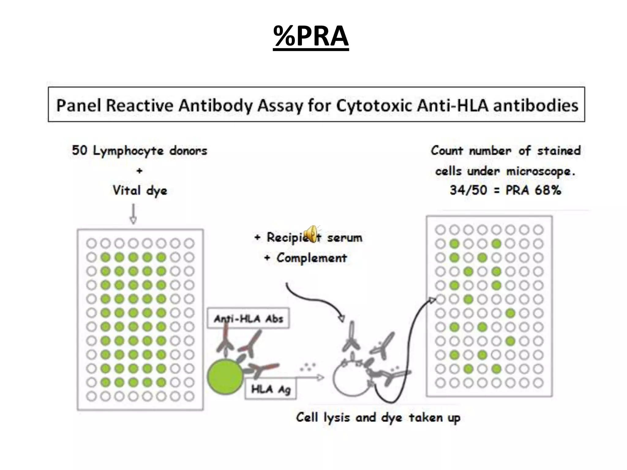 Organ transplantation and the hla system lecture | PPTX
