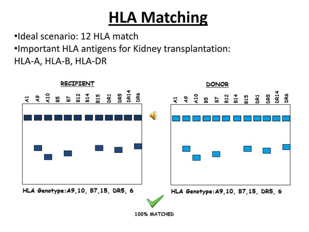 Organ transplantation and the hla system lecture | PPTX | Genetics | Science
