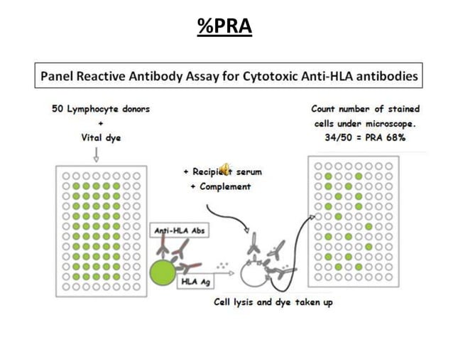 Organ transplantation and the hla system lecture | PPTX | Genetics | Science