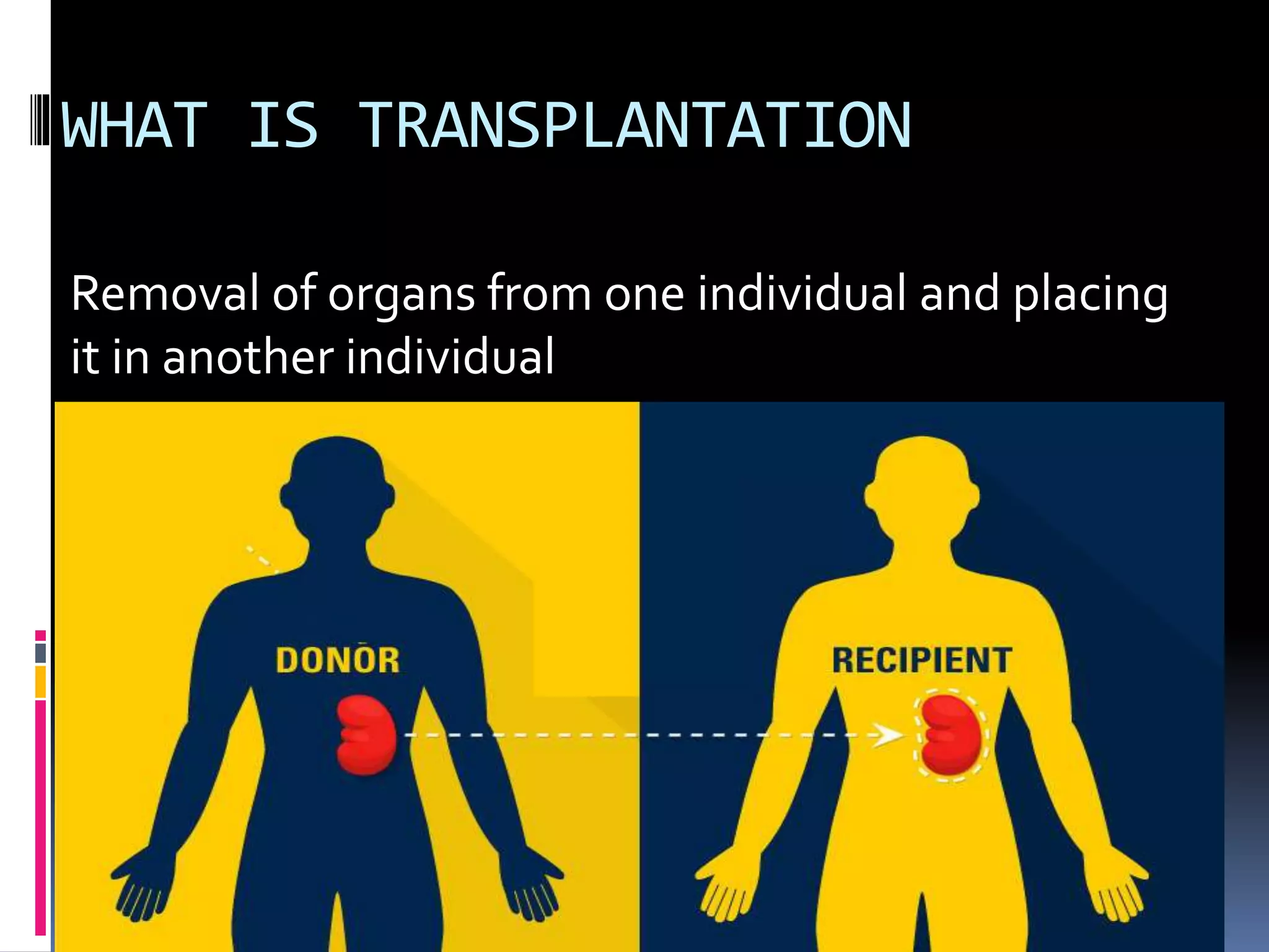 Organ transplantation colombo faculty | PPTX