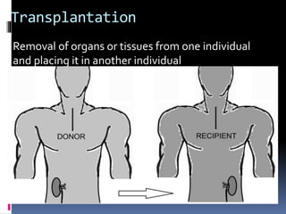 organ transplantation nurses Joel Arudchelvam.pptx