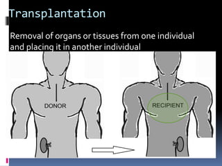 organ transplantation nurses Joel Arudchelvam.pptx