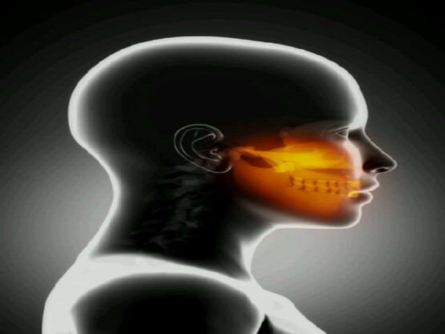 TMJ DISORDERS oral pathology seminar topics | PPT