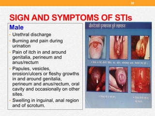 Orientation about HIV, AIDS and STIs | PPTX