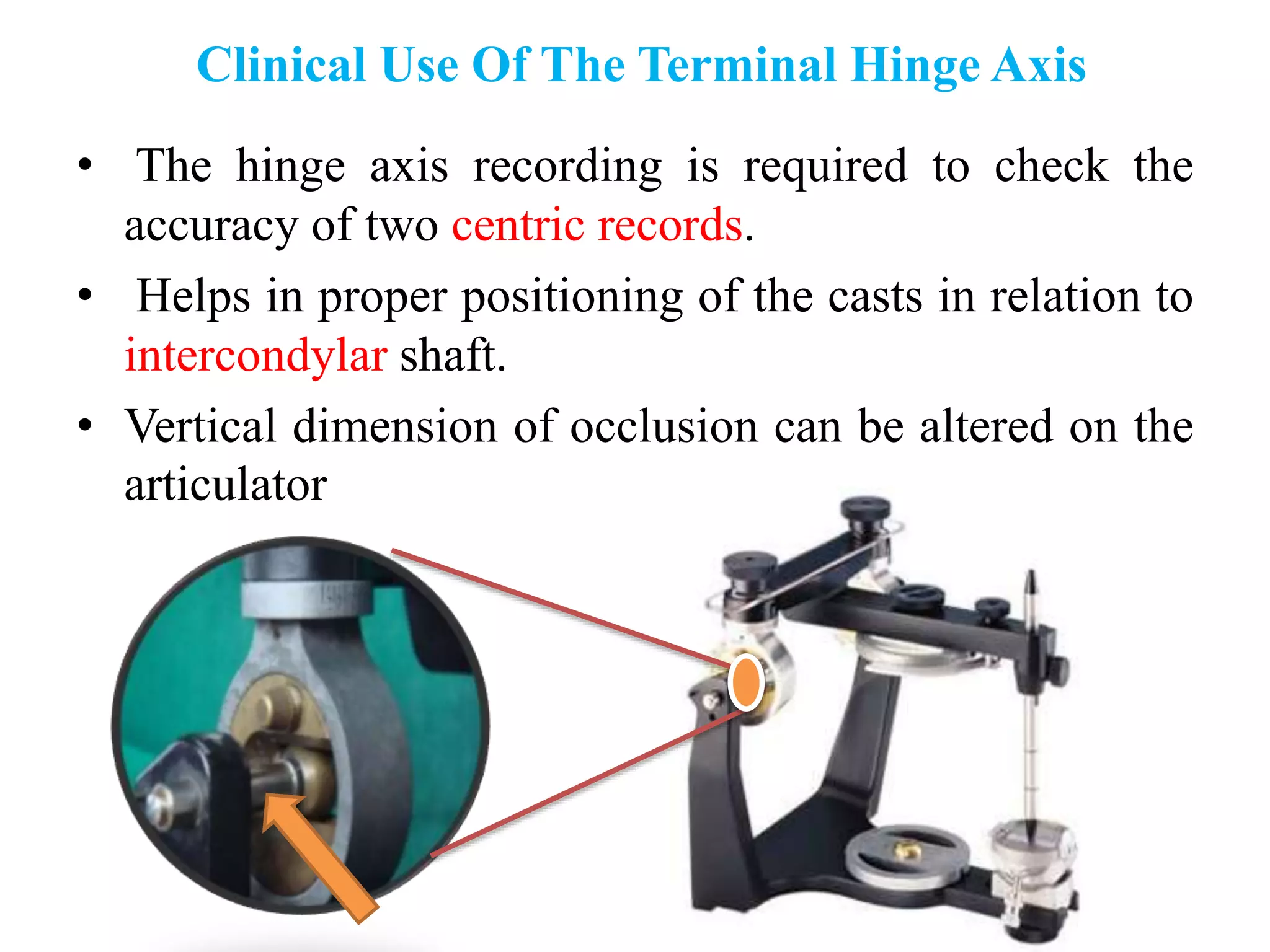 Orientation jaw relation | PPTX