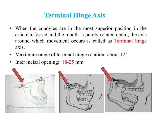 Orientation jaw relation | PPTX