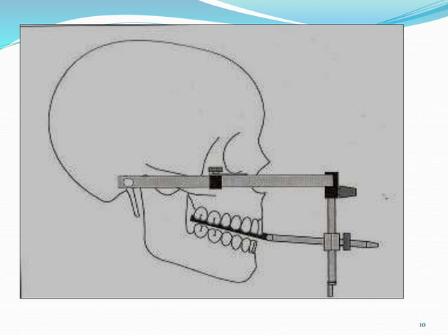 orientation jaw relation.ppt | Dental Health | Diseases and Conditions