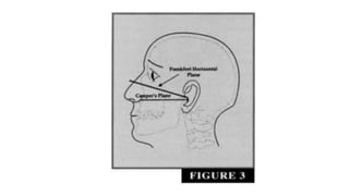Orientation Jaw Relation required for jaw relation procedure | PPT