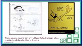 Orientation jaw relation and facebow | PPTX
