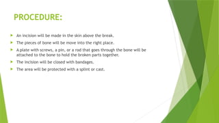 ORIF PRESENTATION (GROUP Six) PowerPoint | PPTX