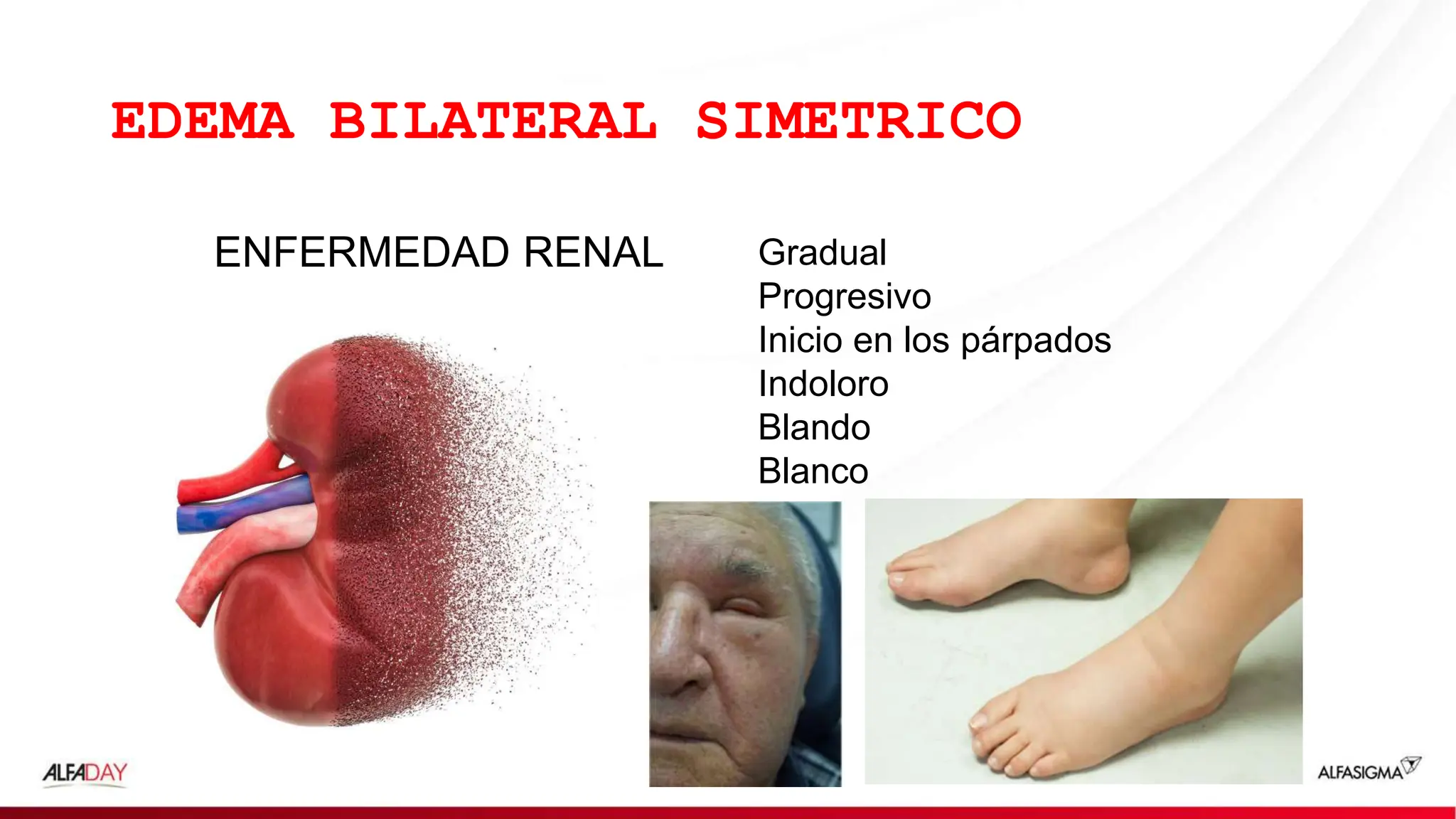 ORIGEN DEL EDEMA EN LA ENFERMEDAD VENOSACRONICA. pptx | PPT