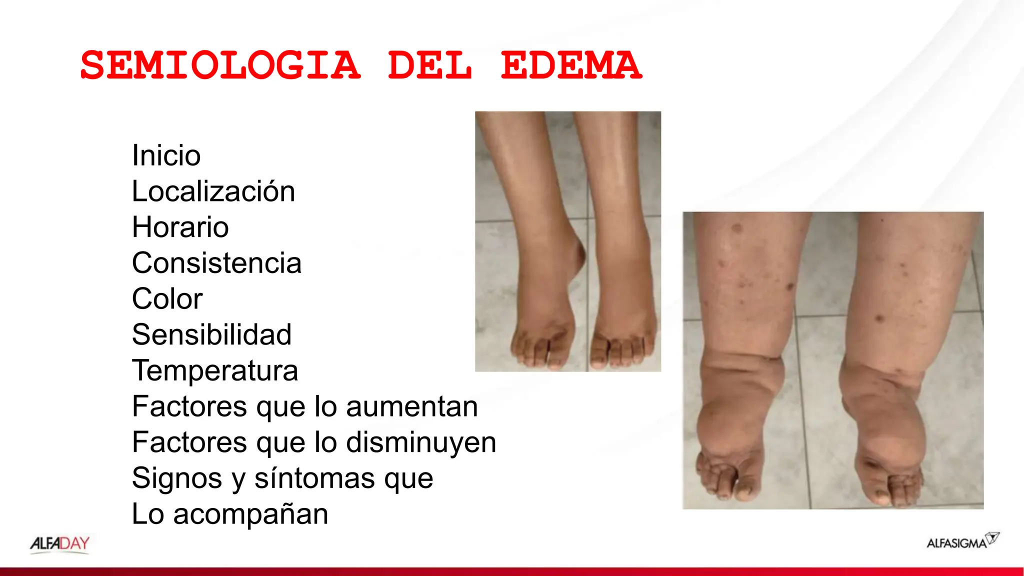 ORIGEN DEL EDEMA EN LA ENFERMEDAD VENOSACRONICA. pptx | PPTX | Medical ...