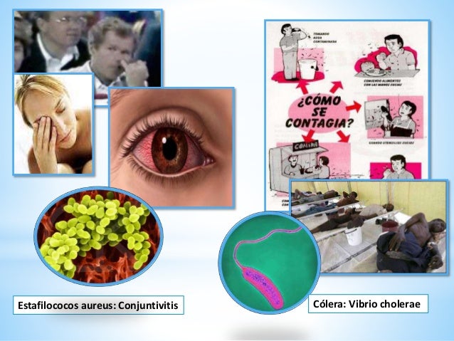 ORIGEN DE LA INFECCIÓN