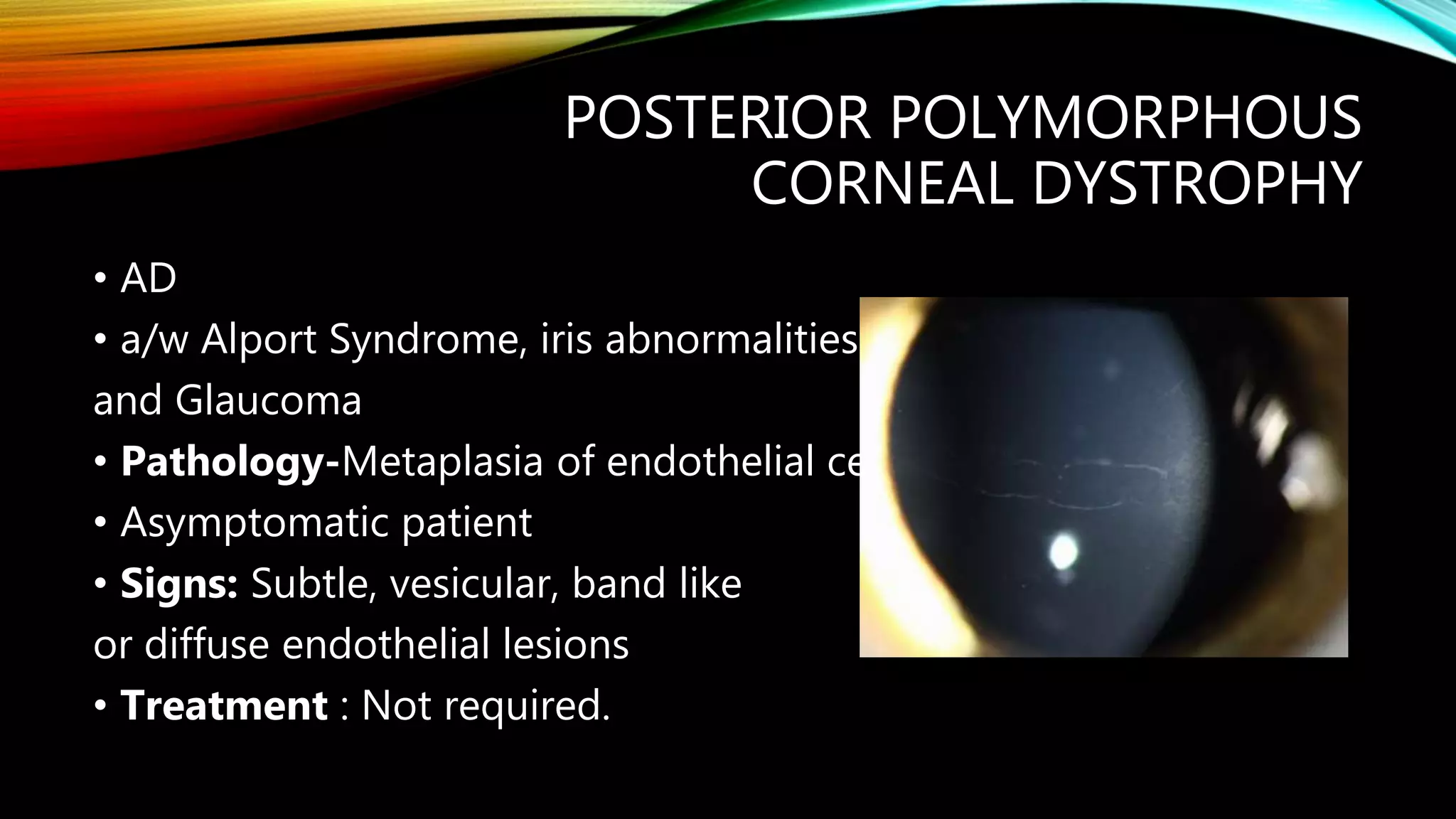 CORNEAL DYSTROPHIES | PPT