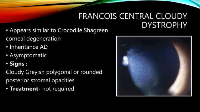 CORNEAL DYSTROPHIES | PPT