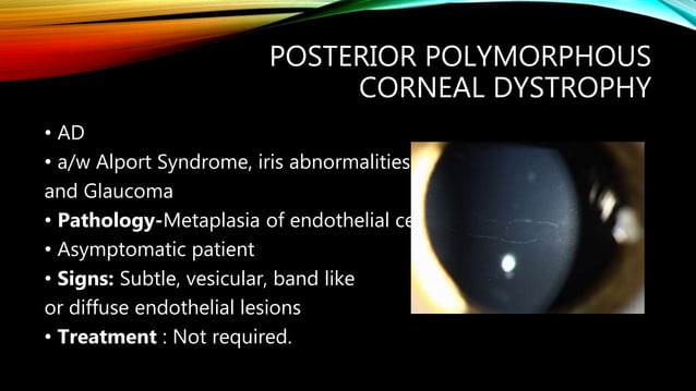 CORNEAL DYSTROPHIES | PPT