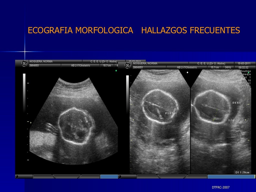 Original ecografia morfologica