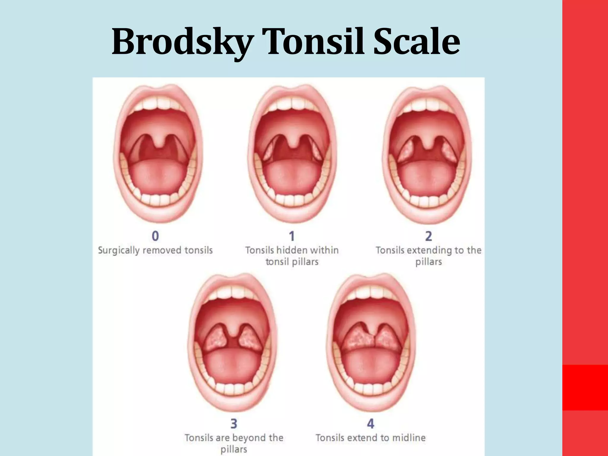 Original prevention remineralization resoration 2013 | PPTX