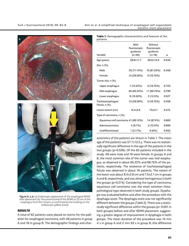 A simplified technique of esophageal self-expandable metallic stent ...