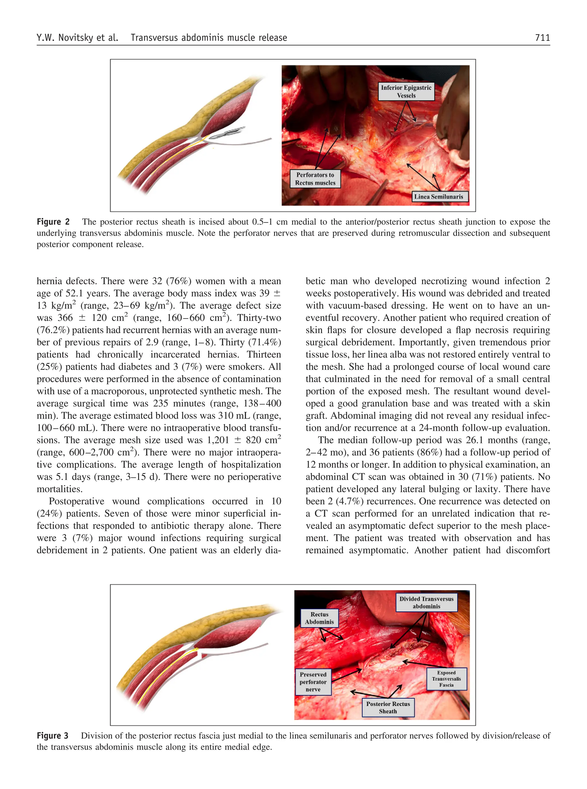 Original TAR article. Novitsky et al.pdf