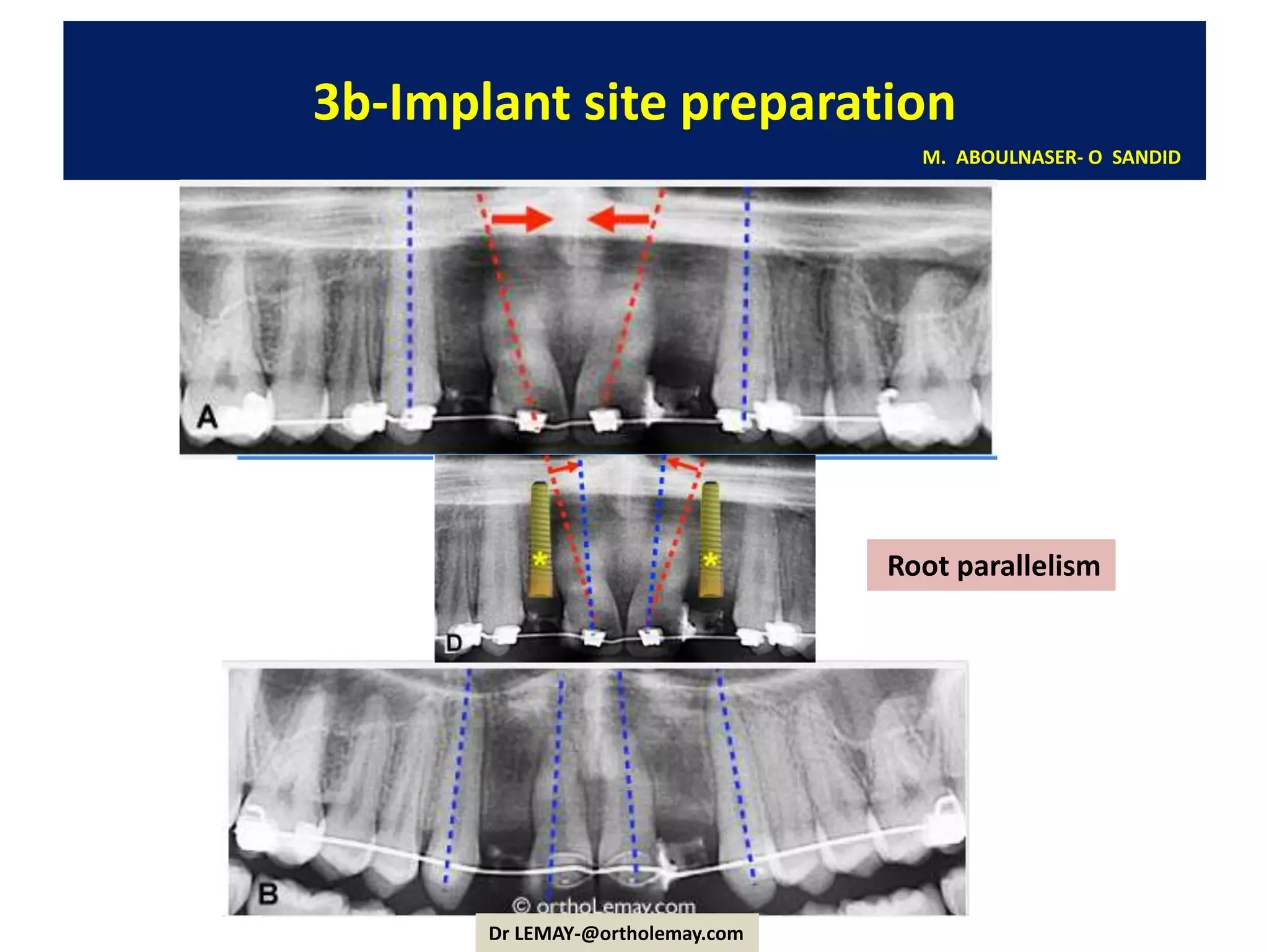 interdisciplinary treatment in orthodontics dr olivier sandid ...