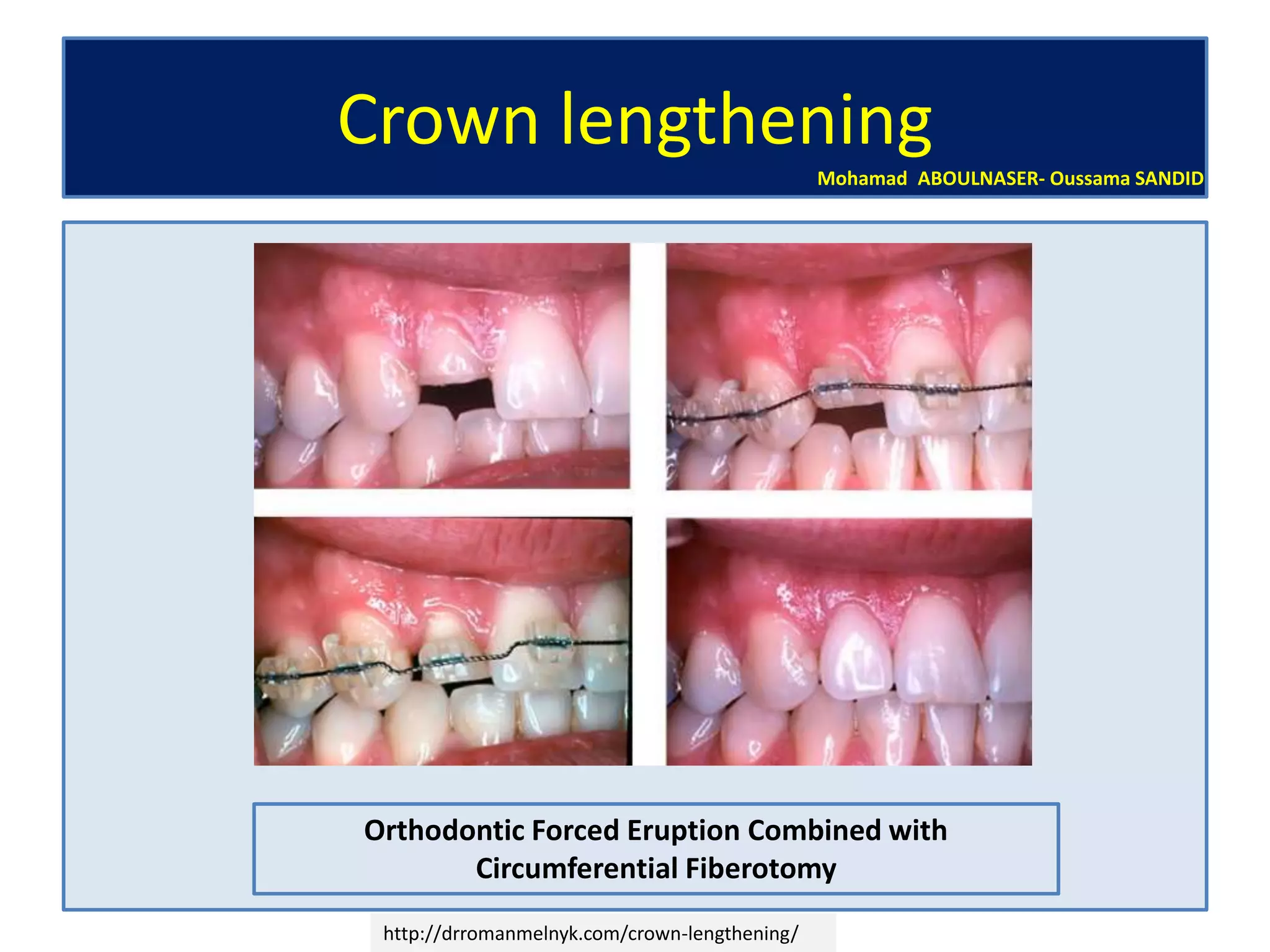 interdisciplinary treatment in orthodontics dr olivier sandid ...