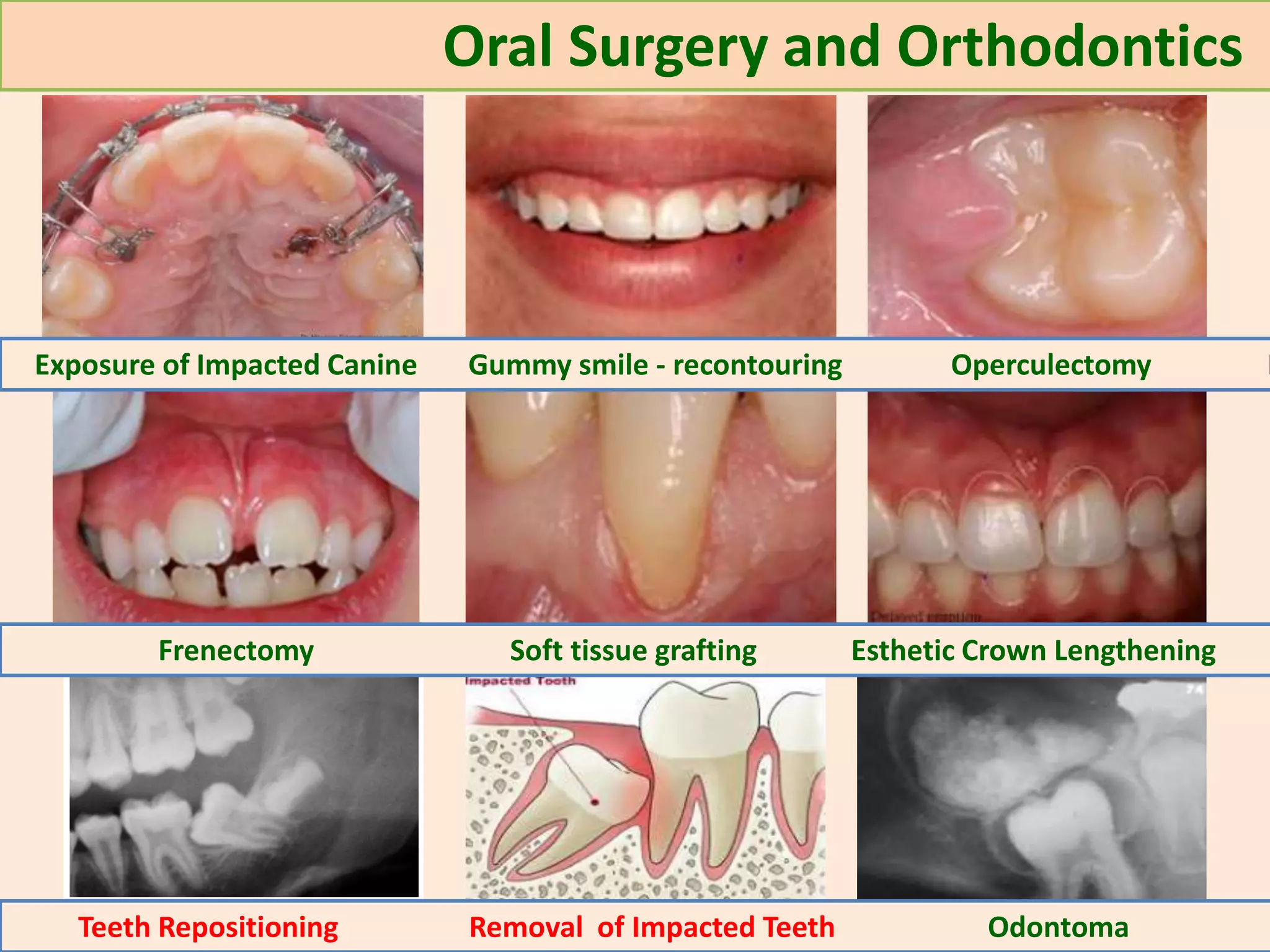 interdisciplinary treatment in orthodontics dr olivier sandid ...