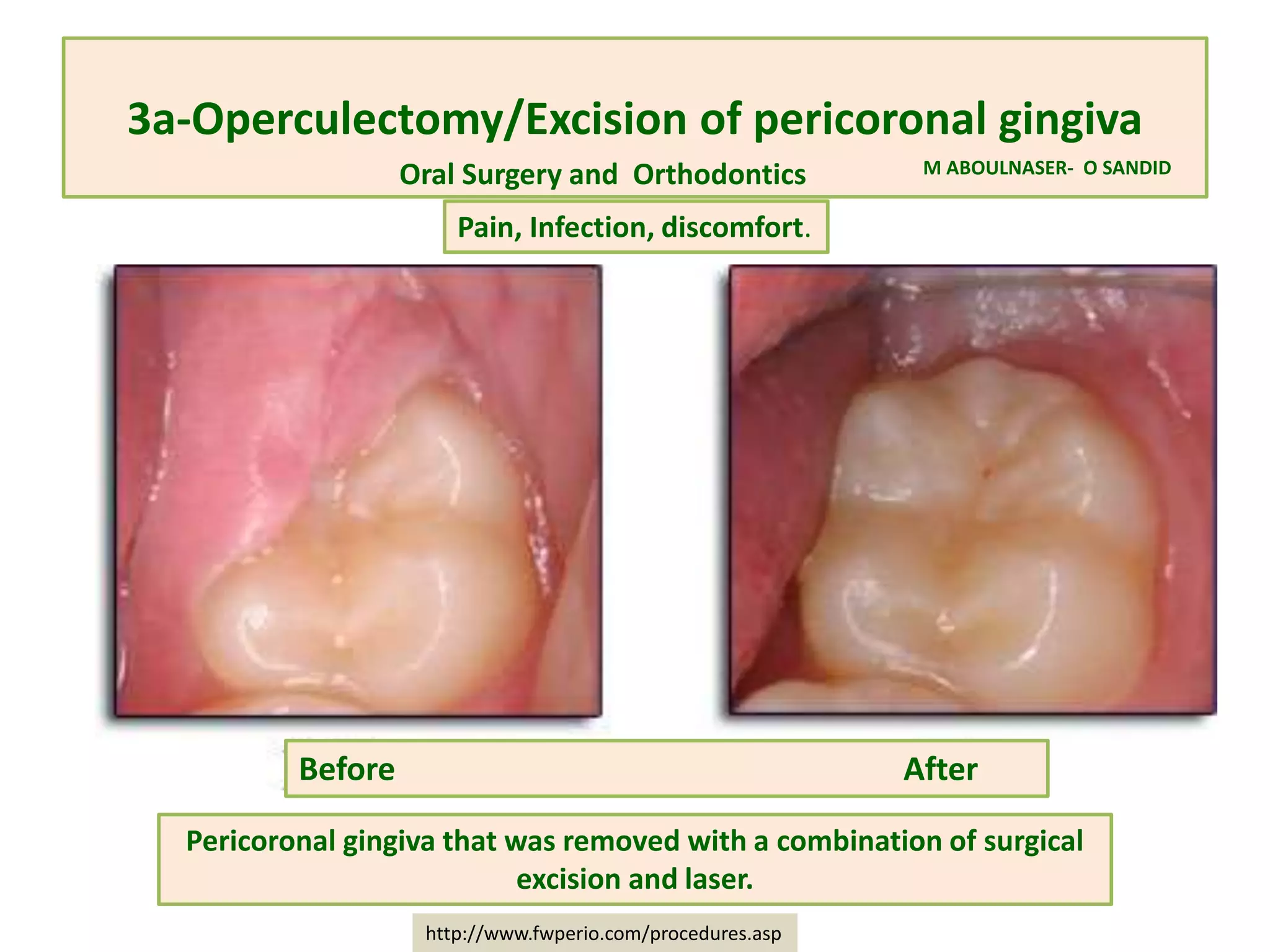 interdisciplinary treatment in orthodontics dr olivier sandid ...
