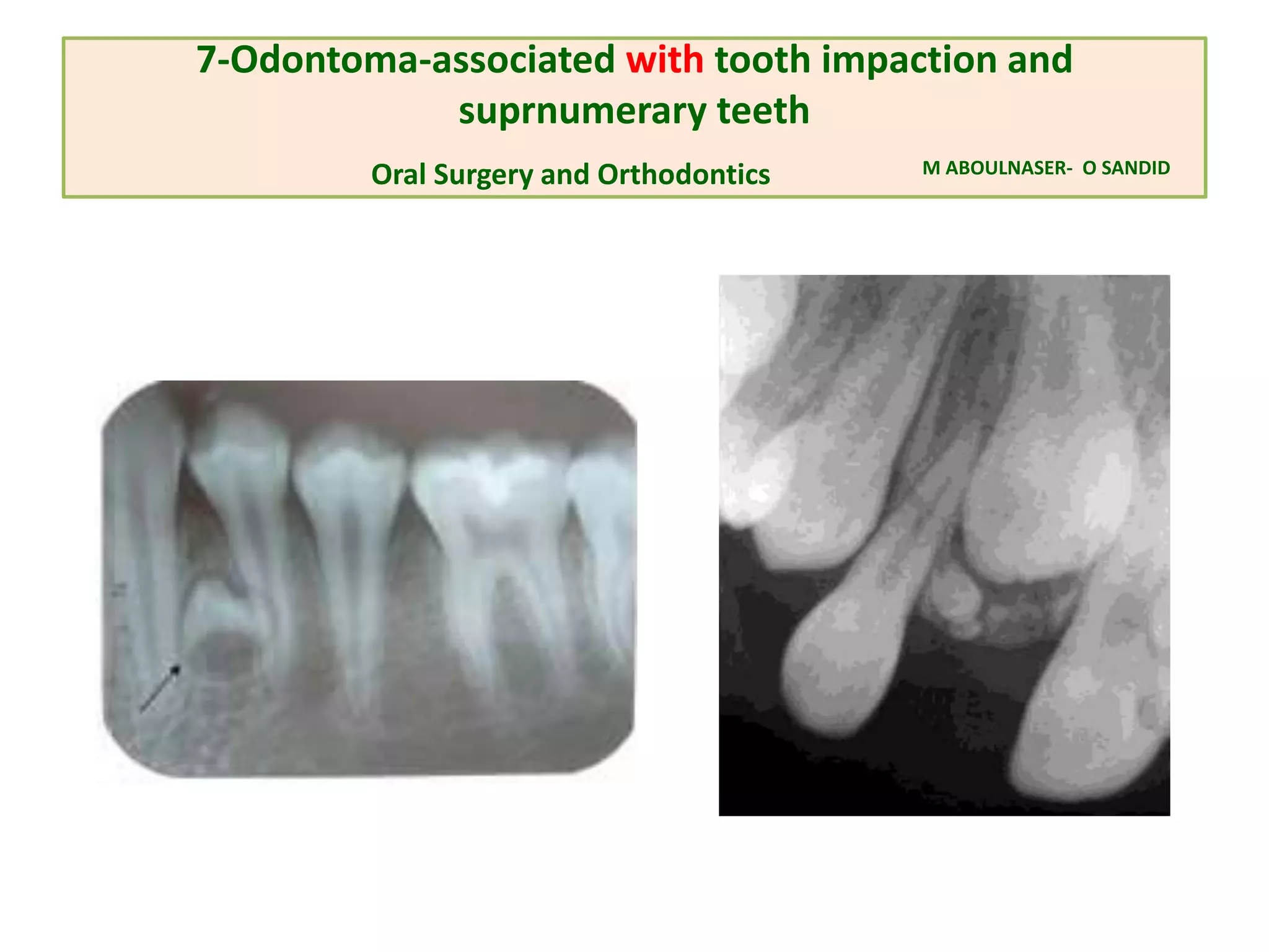 interdisciplinary treatment in orthodontics dr olivier sandid ...